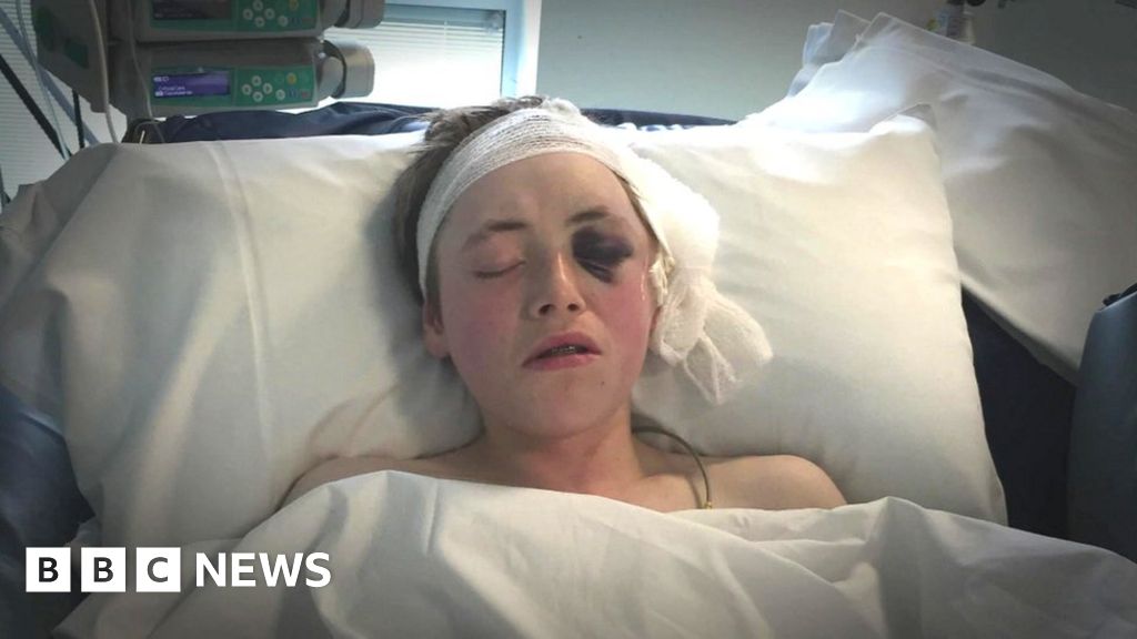 Punch victim 'lucky to be alive' after Manchester attack - BBC News