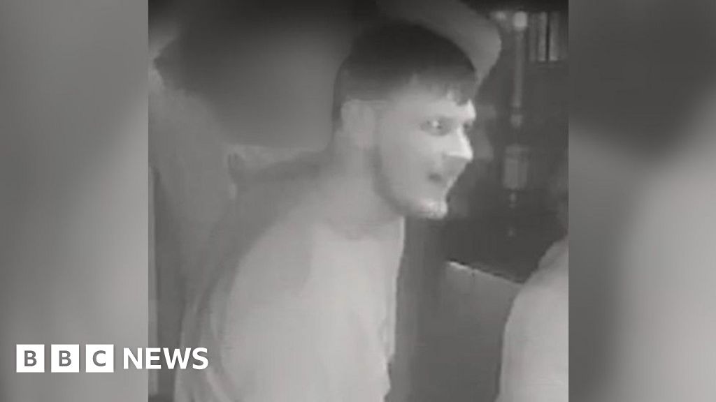 Man suffers brain bleed and broken eye socket in Bath attack