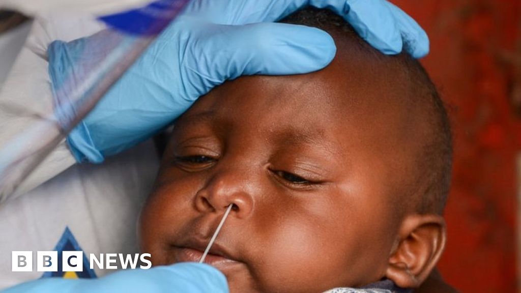 'Aggressive action' needed as Africa coronavirus cases pass 1m 'Aggressive action' needed as Africa coronavirus cases pass 1m