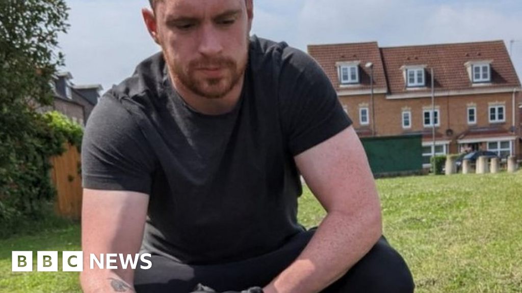 Sunday League player fractures skull during game - BBC News