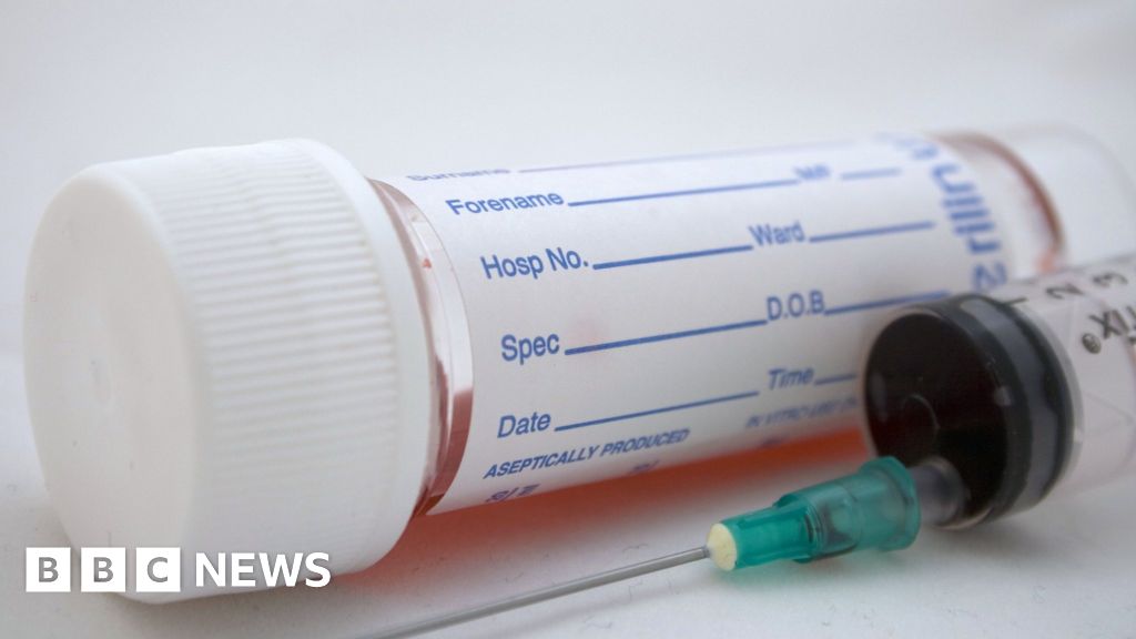 Blood test 'surgery survival predictor' - BBC News