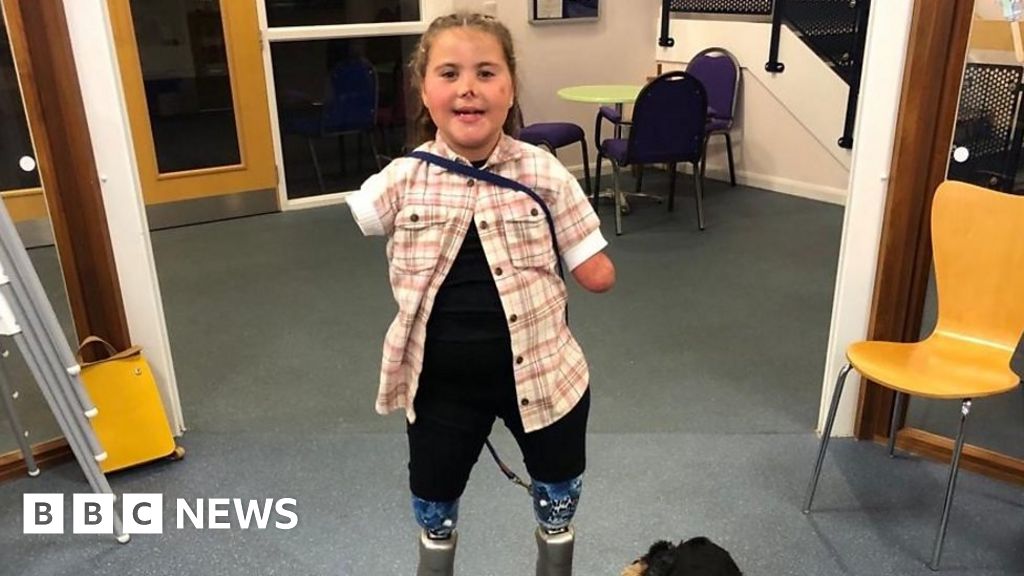 Youngest person to use prosthetic legs with computerised knees - BBC News