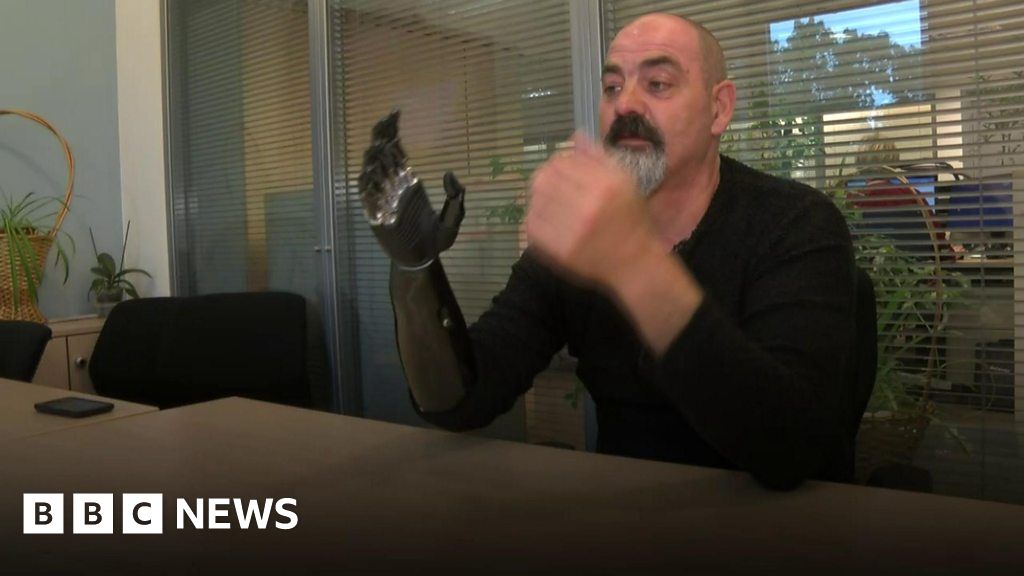 The man on a prosthetic hand mission