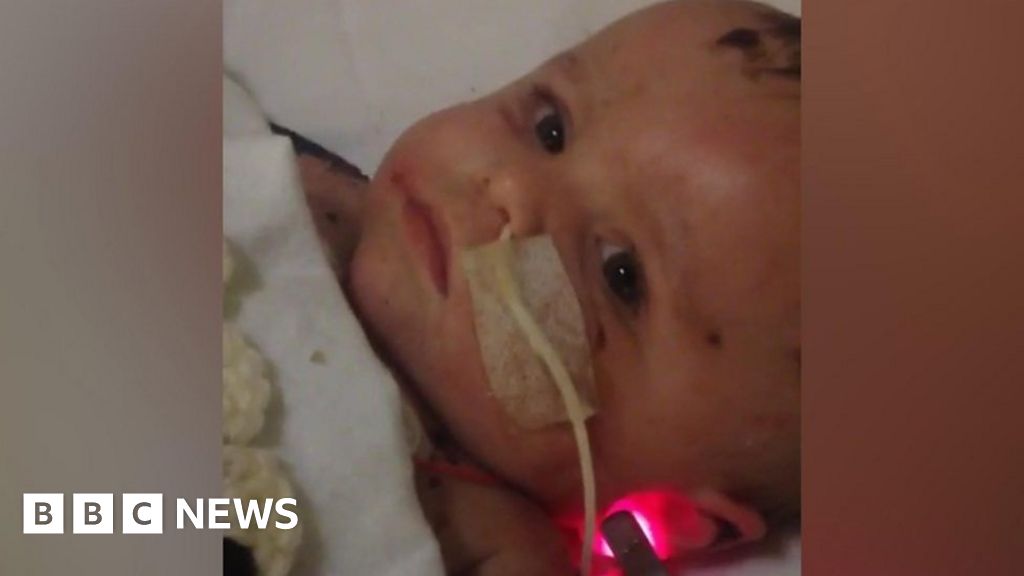 Kia Gott loses four limbs to meningitis