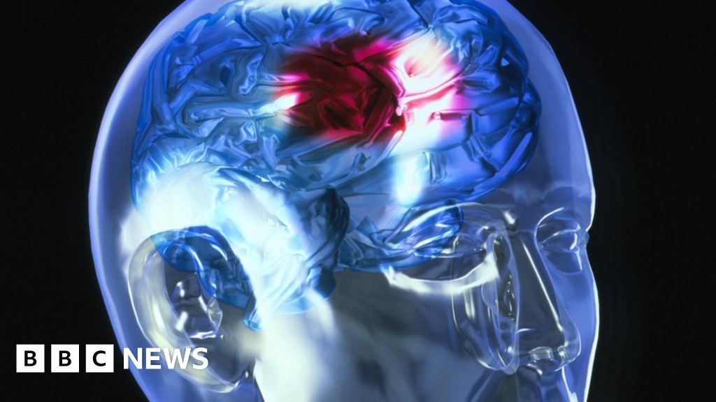 Clot-busting stroke drug safe, says expert review - BBC News