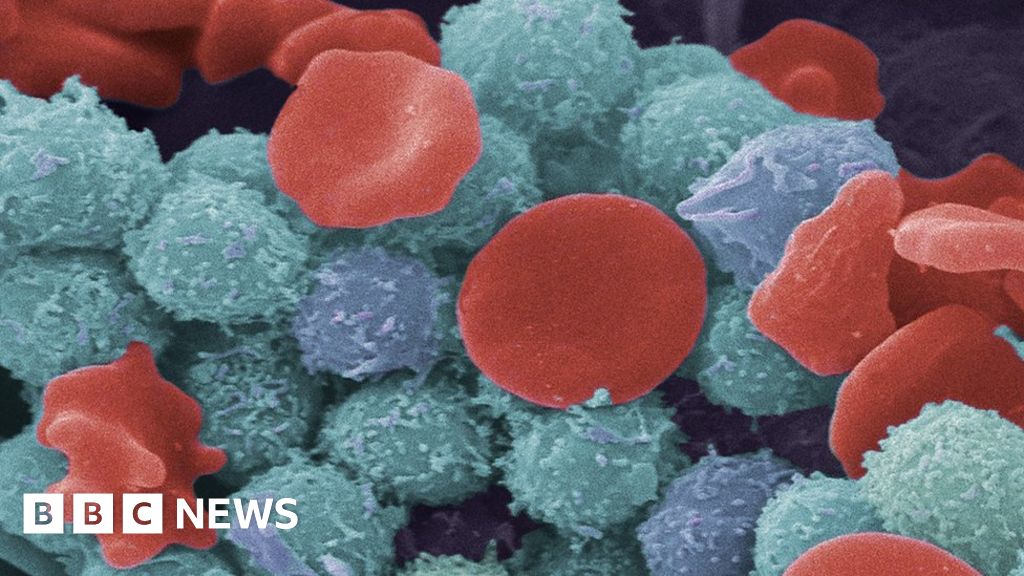Cancer clusters at nuclear sites 'not linked to radiation' - BBC News