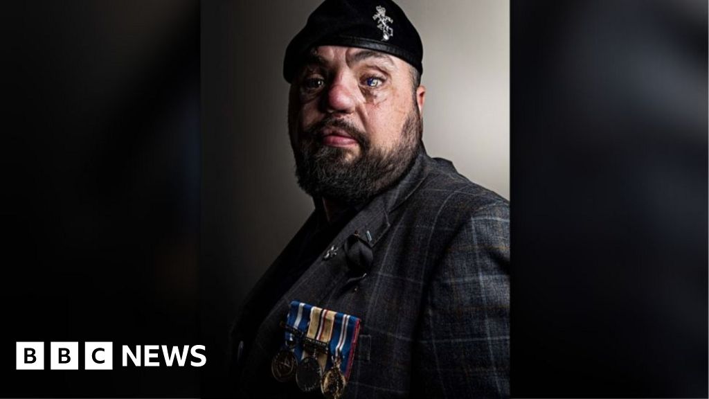 Morley: Veteran shot by sniper to join march at Cenotaph - BBC News