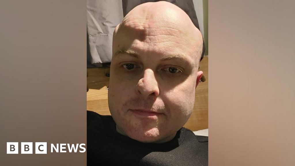 Coroner criticises Sheffield NHS trust after man's suicide - BBC News