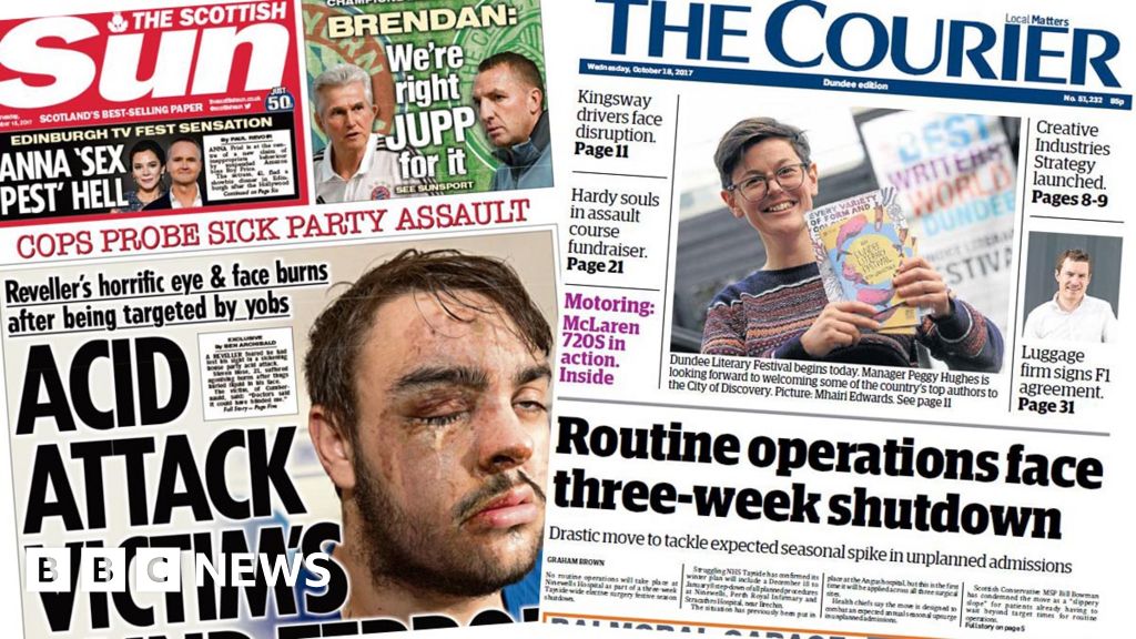 Scotland's papers: Party 'acid' attack probe - BBC News
