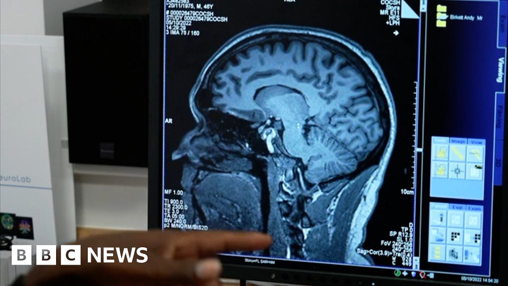 How rugby is tackling brain health