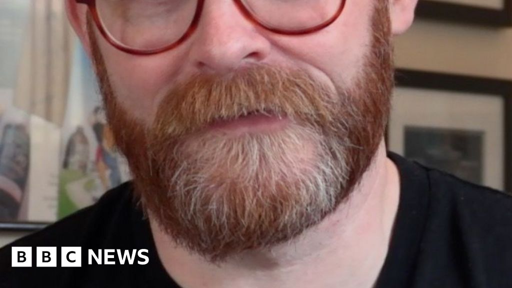Amputee from Dorset builds his own leg with parts found online - BBC News