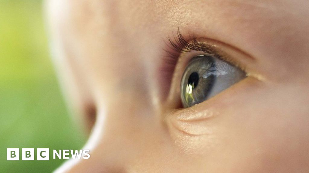 Gene therapy for rare eye disease set to be offered on NHS
