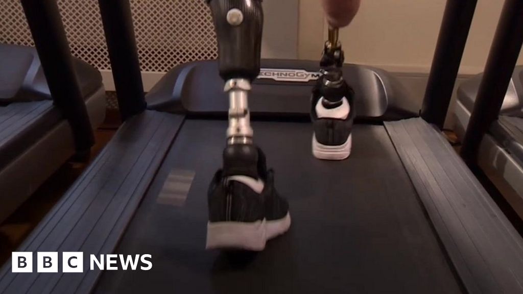 The man who chose to replace his leg with a bionic version - BBC News