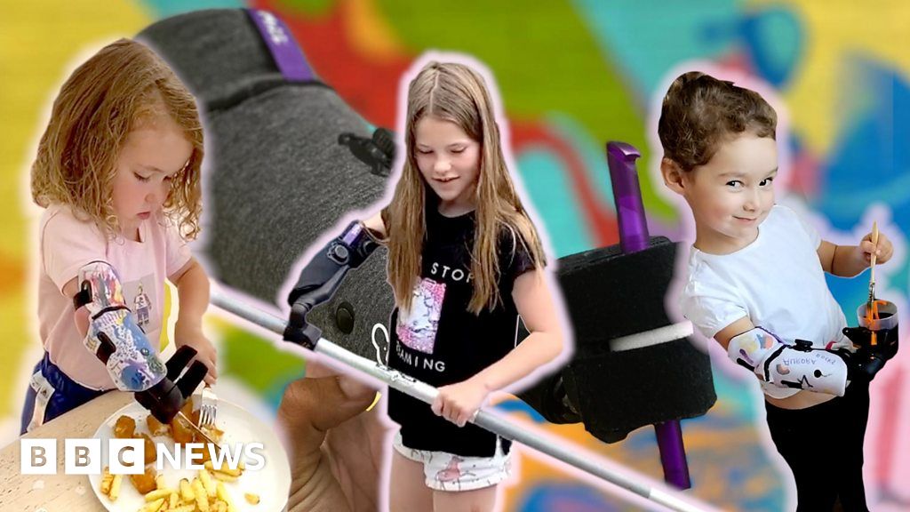 Prosthetic limb backed by quadruple amputee Alex Lewis - BBC News