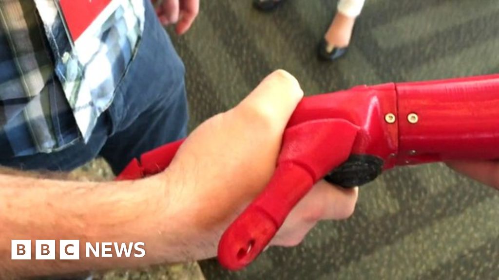 Open Bionics robotic hand for amputees wins Dyson Award - BBC News