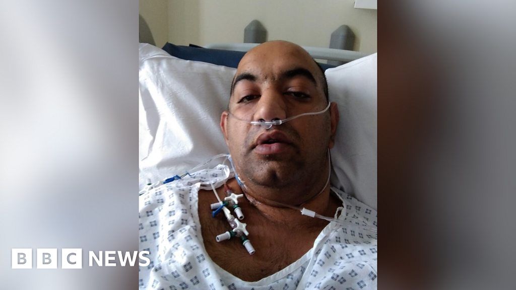 Organ donation: Man gets his third kidney transplant - BBC News