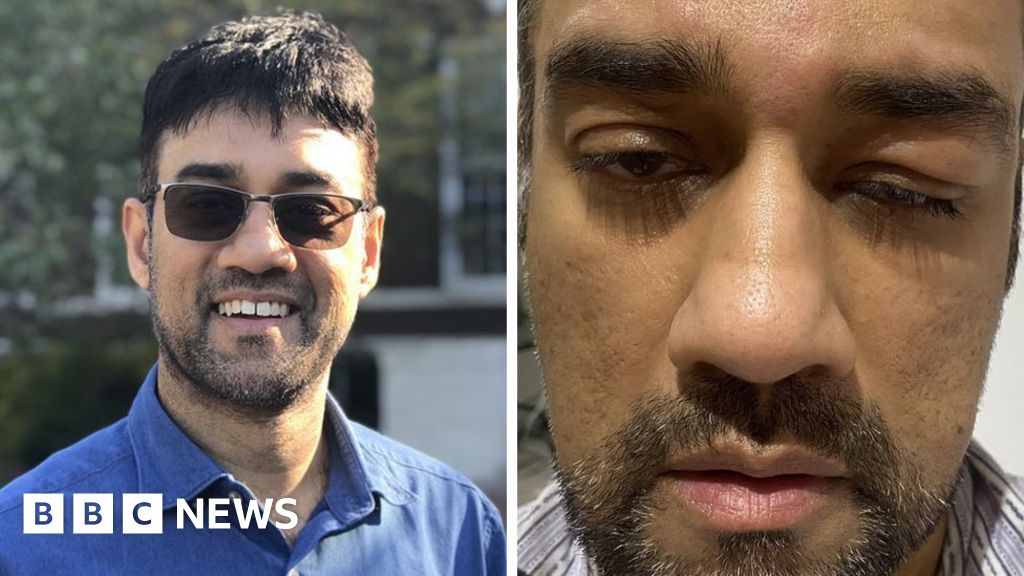 Long Covid pay decision for key workers could take a year