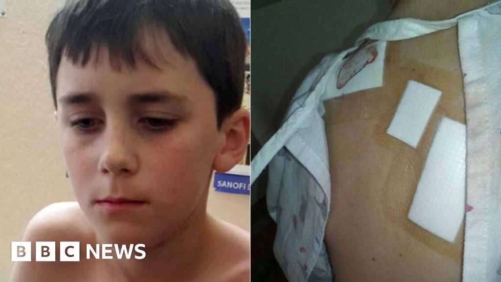 Cheetah attack survivor: Boy's parents want cat freed - BBC News