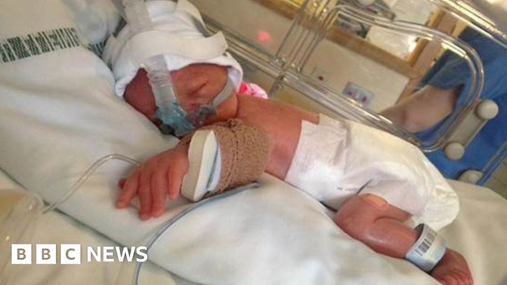 Parents of premature babies 'need financial support' - BBC News