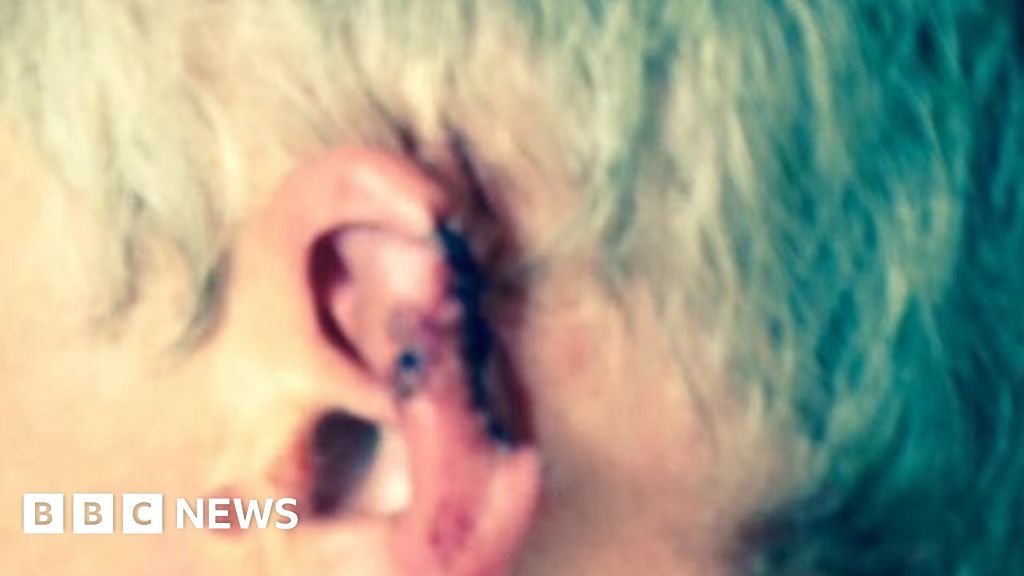 Man had ear bitten off at Splendour Festival - BBC News