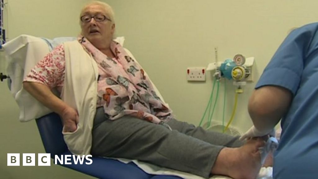 Doctors celebrate success in saving limbs of diabetics - BBC News