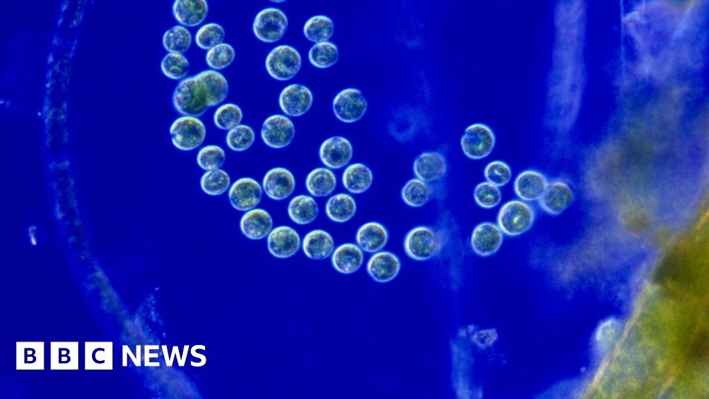 Bacteria 'see' like tiny eyeballs - BBC News