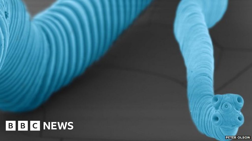 How did man die of cancer from a parasitic worm? - BBC News