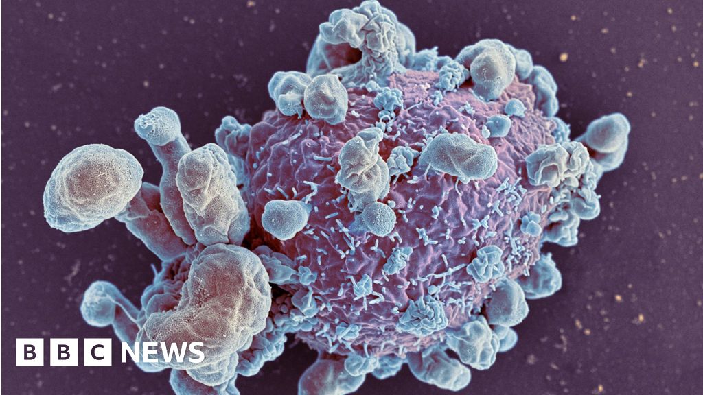 Artificial Intelligence 'outsmarts cancer' - BBC News