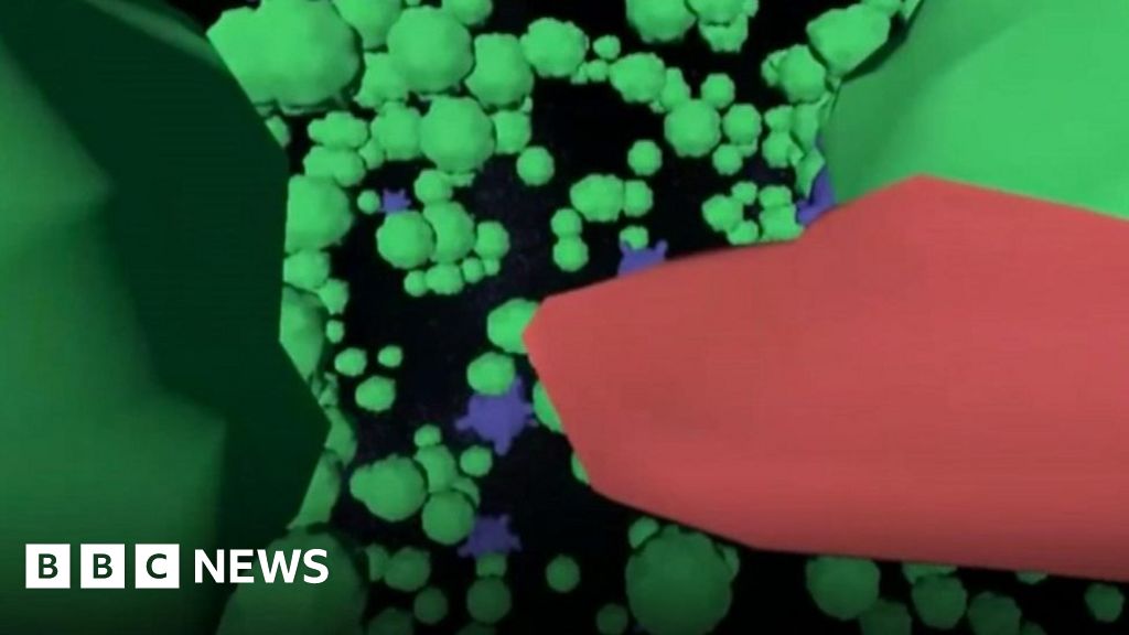 Cancer Research UK: Cambridge scientists awarded £20m grant - BBC News