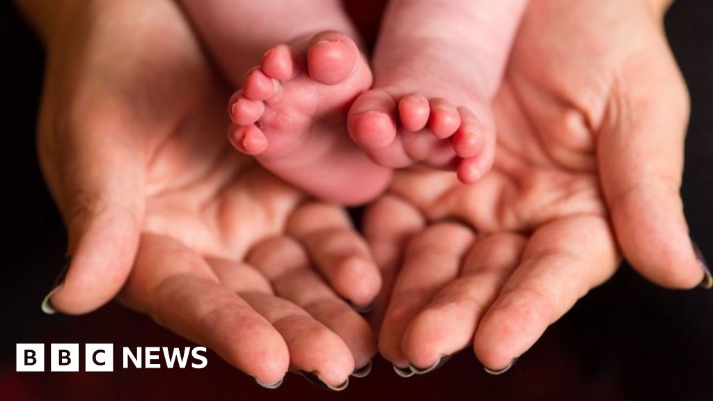 'Shaken baby' has rare bruising condition Ehlers-Danlos syndrome - BBC News