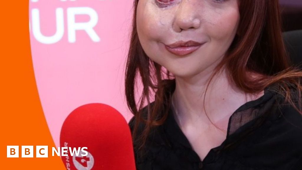 Nikki Lilly: Self-acceptance is a 'real work in progress' - BBC News