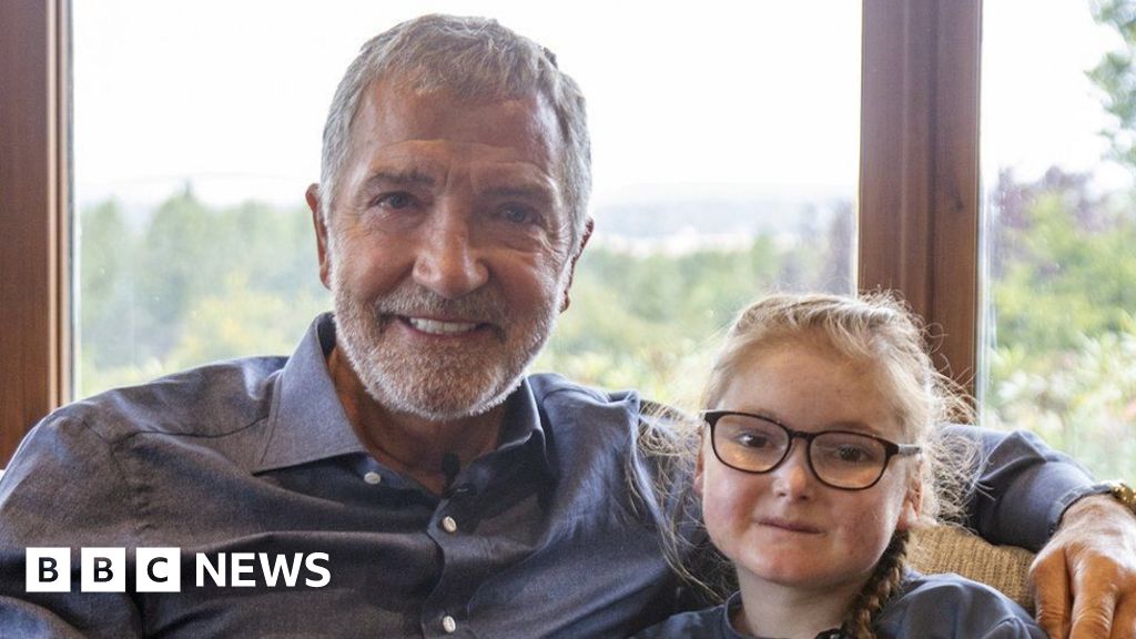 Graeme Souness takes on new challenge for skin disease charity - BBC News