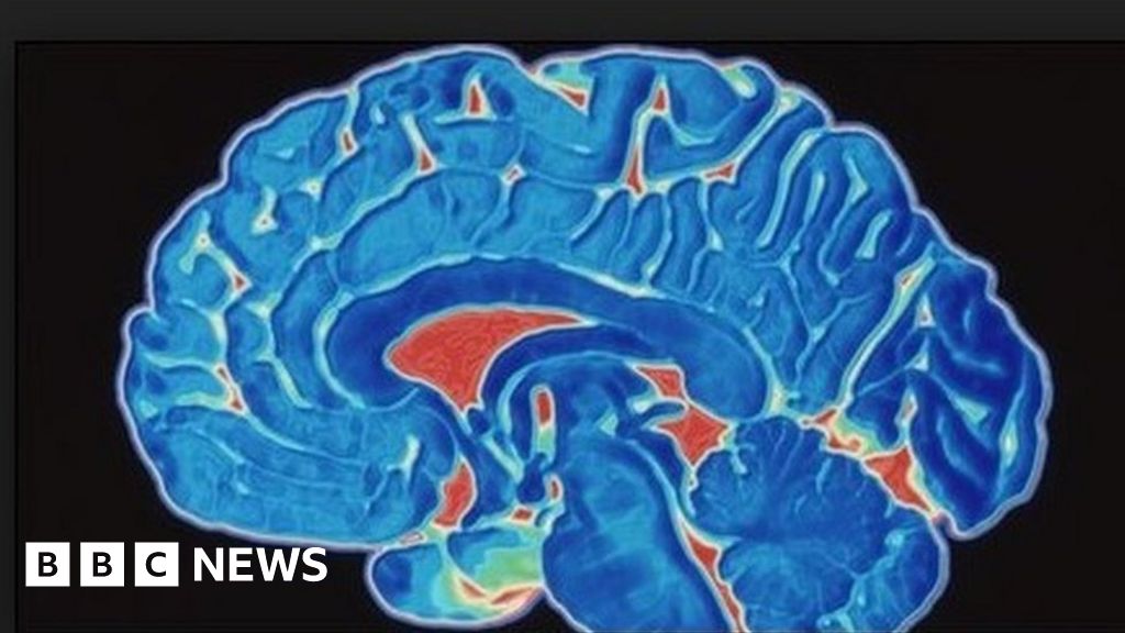 Brain scans used to examine psychiatric disorders - BBC News