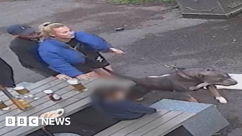 Strelley dog attack victim spends week in hospital