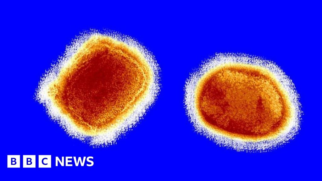 World faces big challenges over Covid, monkeypox and wars - WHO