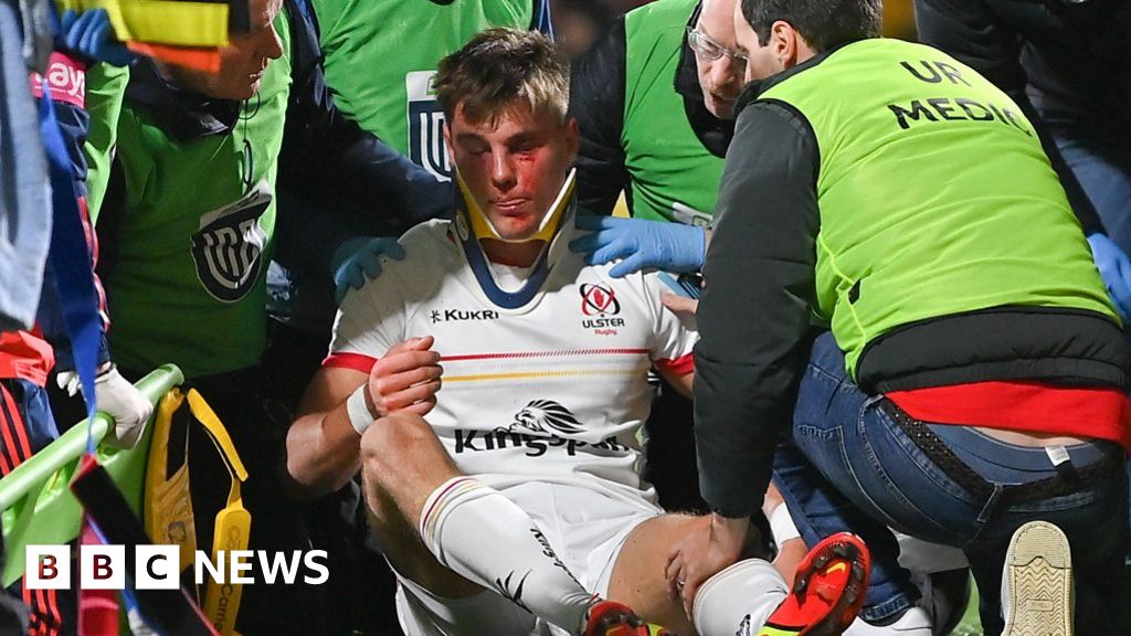 Can smart mouthguards reduce rugby head injuries? - BBC News