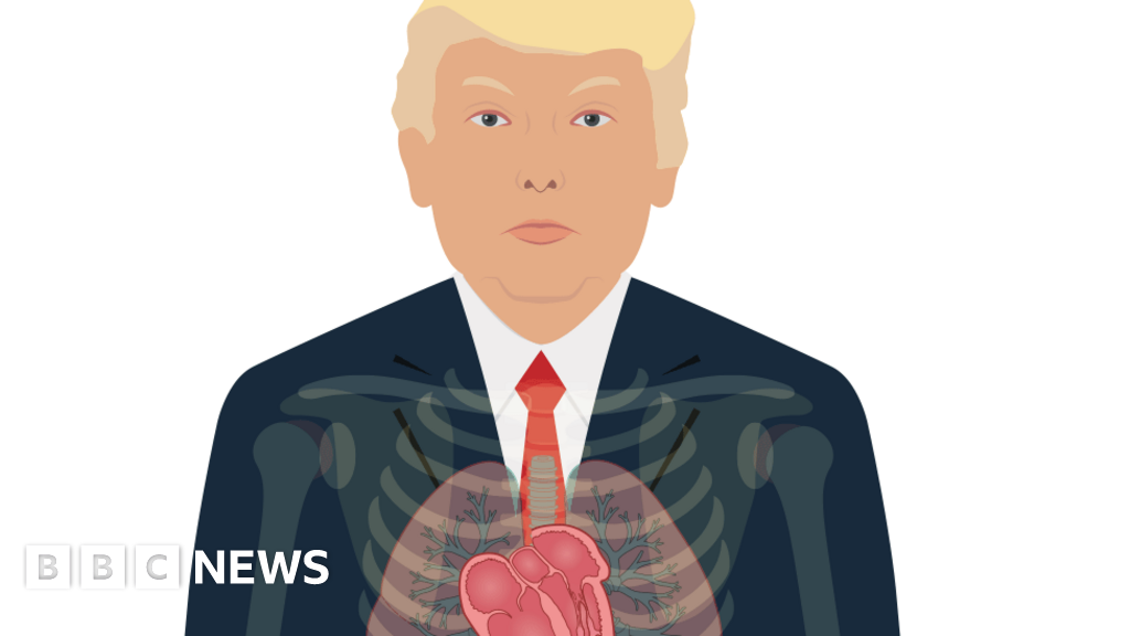 Donald Trump's medical: What will it reveal? - BBC News