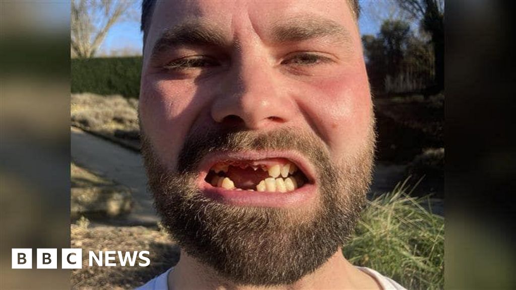 Farningham man loses nine teeth in suspected catapult attack