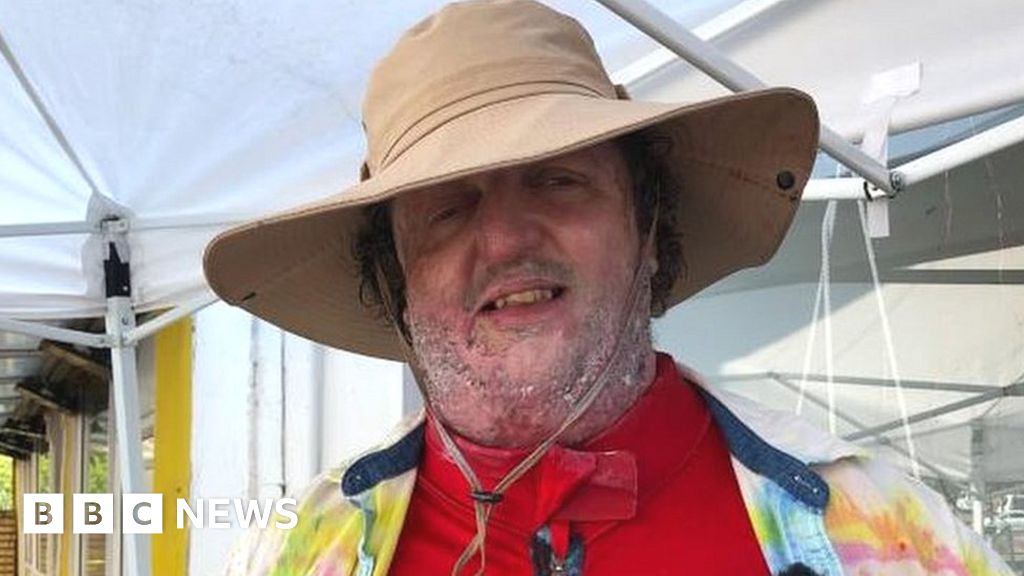 Bristol's Big Jeff back at gigs after recovering from fire - BBC News