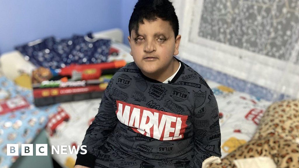 Fraser Syndrome: 'When Santa writes to me in Braille, I feel included'