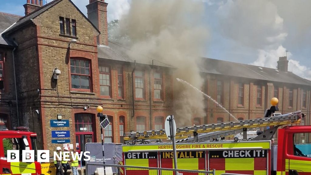 Watford General Hospital fire sees patients and staff evacuated - BBC News