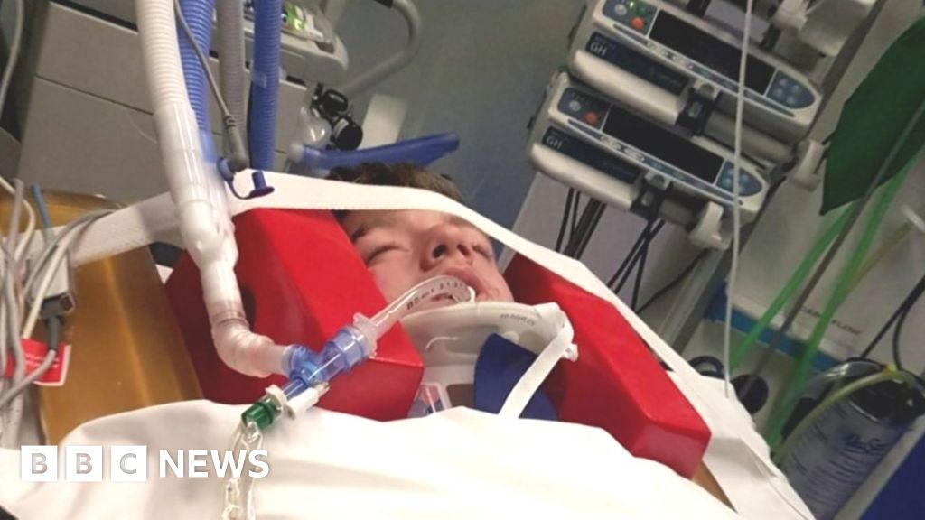 Belfast mother releases coma image of son as a drug warning - BBC News