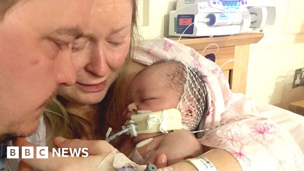 Baby Puck parents say 'information could have saved' son's life - BBC News