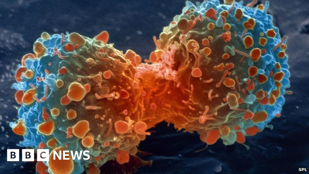 Spying on cell eating habits 'may help cancer diagnosis' - BBC News
