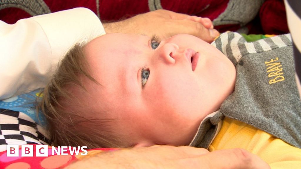 Spina bifida: Parents hope surgery in womb will help son walk - BBC News
