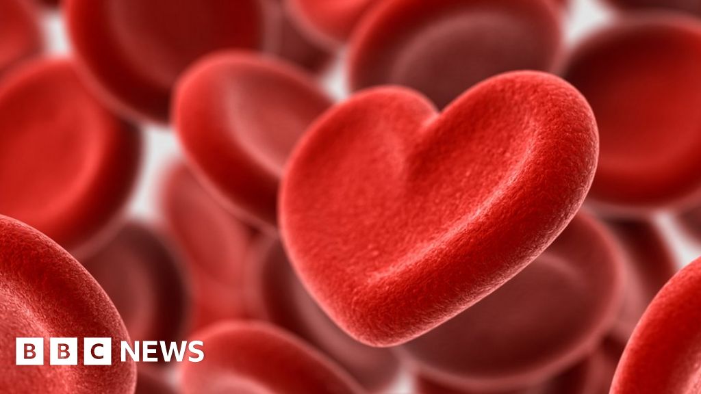 'Check your cholesterol from age 25' - BBC News