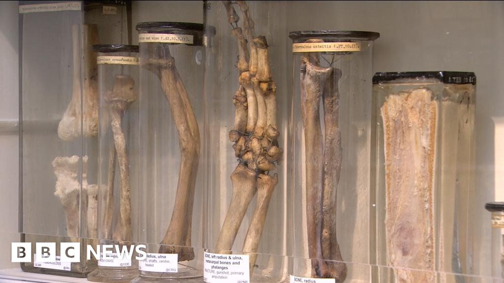 A peek inside revamped Surgeons' Hall medical museum - BBC News