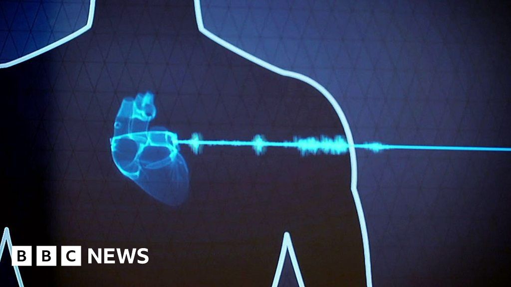New health scan uses artificial intelligence - BBC News