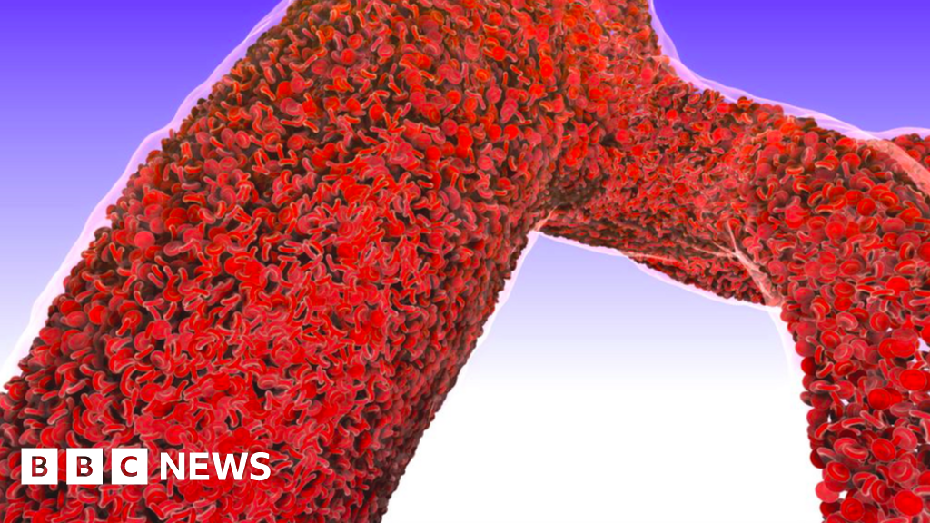 Supercomputer simulates whole-body blood flow - BBC News