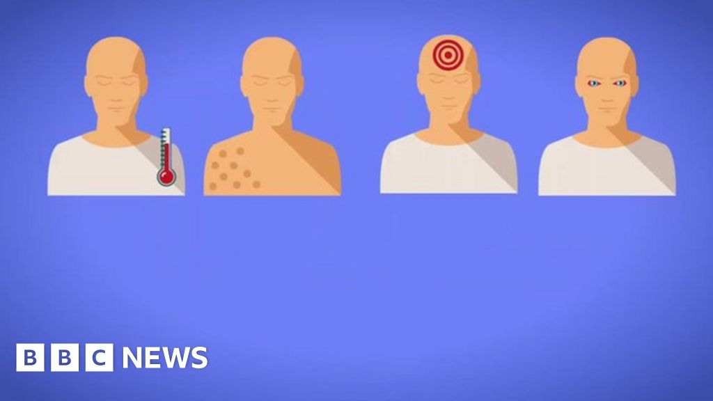 Zika virus: What you need to know - BBC News